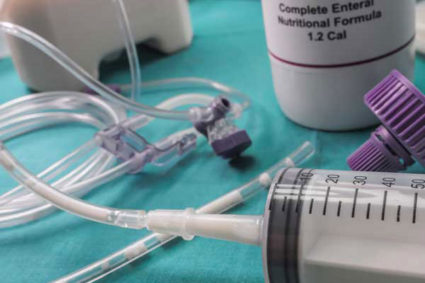 Enteral Feeding and Management – Diligent Care Services